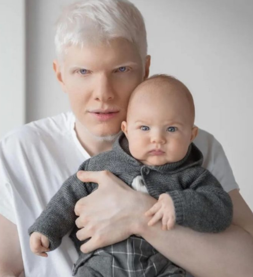 Wie sieht der Sohn eines Models und der schönste Albino der Welt aus ...
